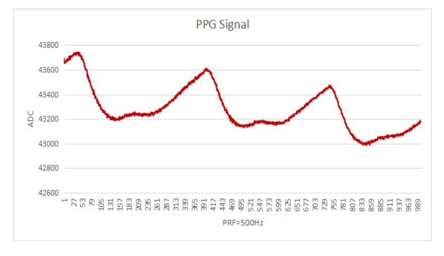 芯海科技CS1262的高性能低功耗穿戴式血氧方案应用 - 脉脉