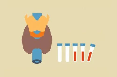 抗甲状腺球蛋白抗体(TGAb)偏高是什么情况？-河南美凯生物科技有限公司