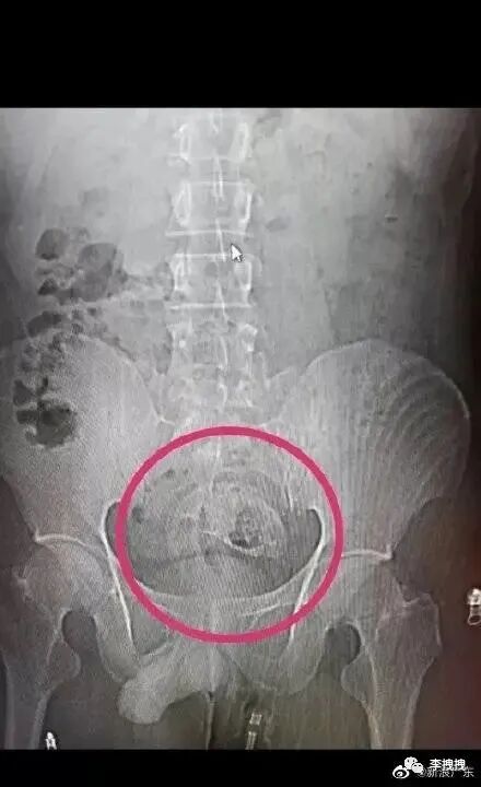 喜欢走后门的年轻人，有多魔幻？ -6park.com