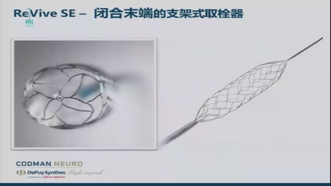 彭亚教授：急性缺血性卒中的取栓技术与材料应用 - 脑医汇 - 神外资讯 - 神介资讯