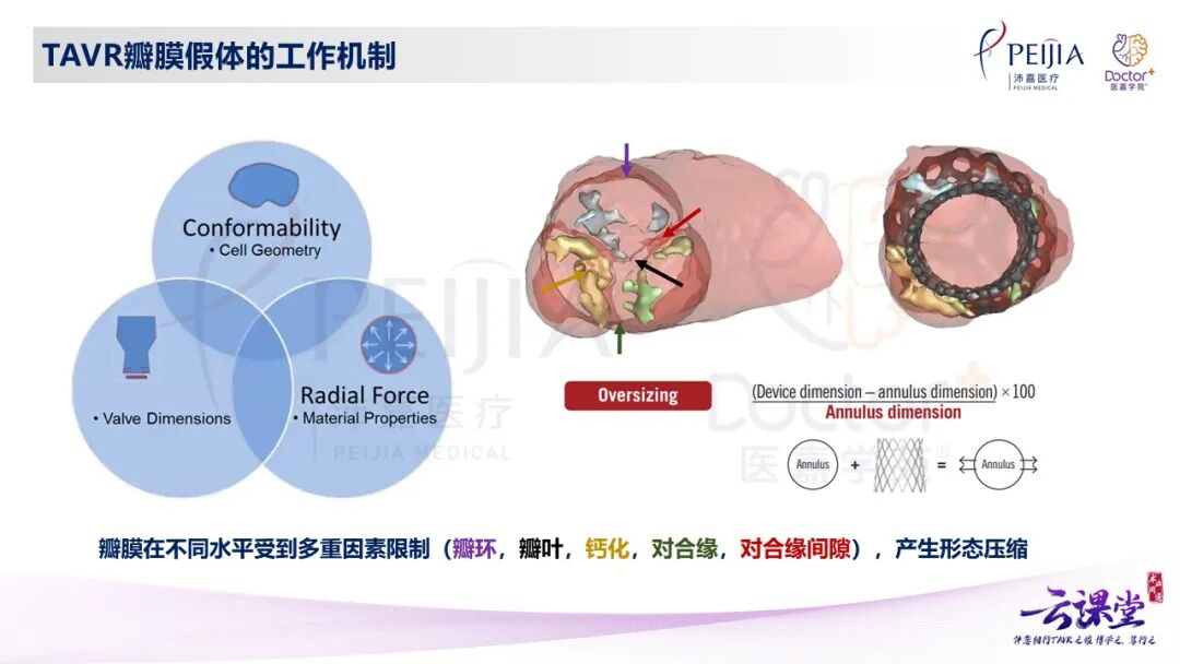 博学·笃行丨术业闻道·云课堂第四季《AS患者TAVR术前策略——层层解析全面制定》精彩回顾 -- 严道医声网
