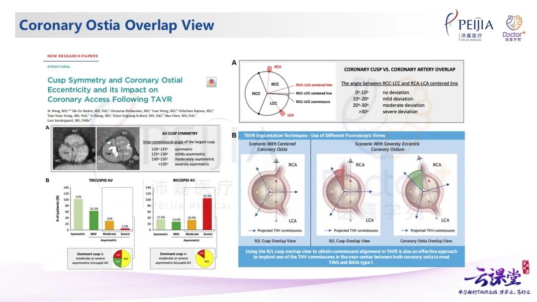 博学·笃行丨术业闻道·云课堂第四季《AS患者TAVR术前策略——层层解析全面制定》精彩回顾 -- 严道医声网