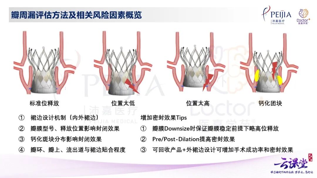 博学·笃行丨术业闻道·云课堂第七季《AS患者TAVR并发症管理——提前预防，积极处理》精彩回顾 -- 严道医声网