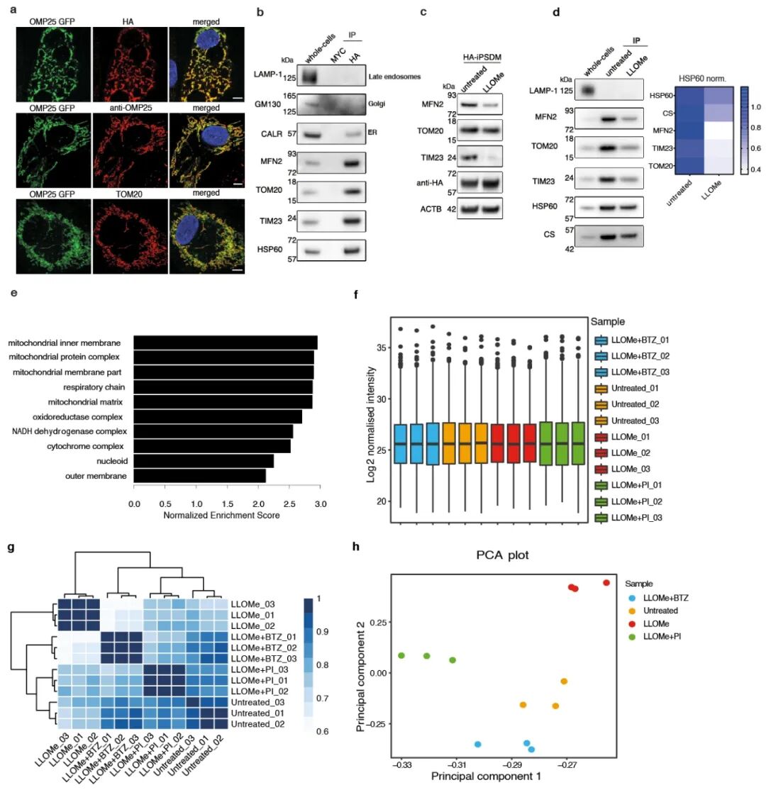 科学网—Nature commun∣溶酶体损伤驱动线粒体蛋白质组重塑和重编程巨噬细胞免疫代谢 - 杨鸽的博文