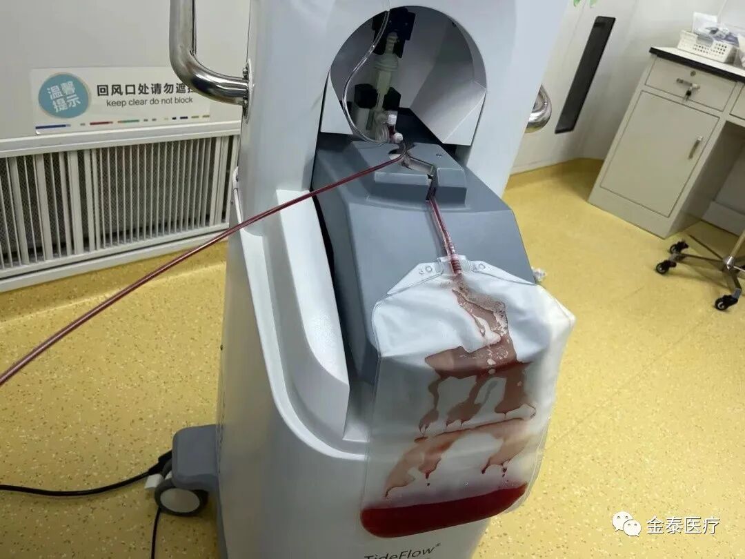 企业动态 | 金泰医疗：TideFlow®系统助力无锡首家成功开通人工血管内瘘通路医药新闻-ByDrug-一站式医药资源共享中心-医药魔方