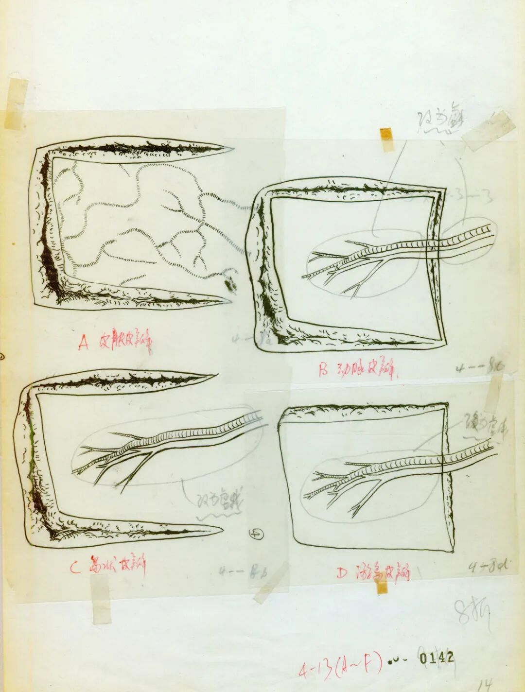 收藏：中国手外科手术切口及入路绘图原稿！-德医医学-助力医学教育发展！