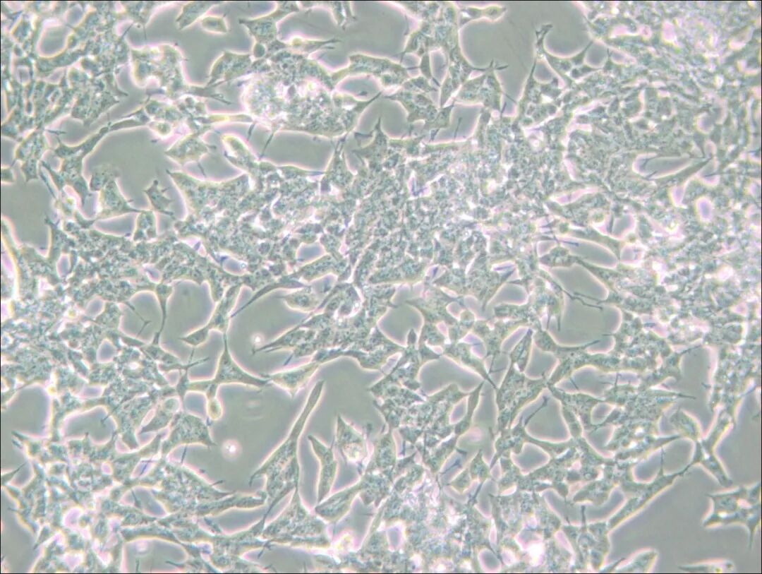 如何养好SH-SY5Y_技术资讯_上海雅吉生物科技有限公司