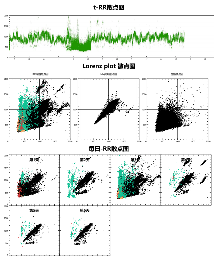 卡帕奇心电贴临床应用病例分享（八十一）I 高血压、房颤患者心律失常筛查 - 脉脉