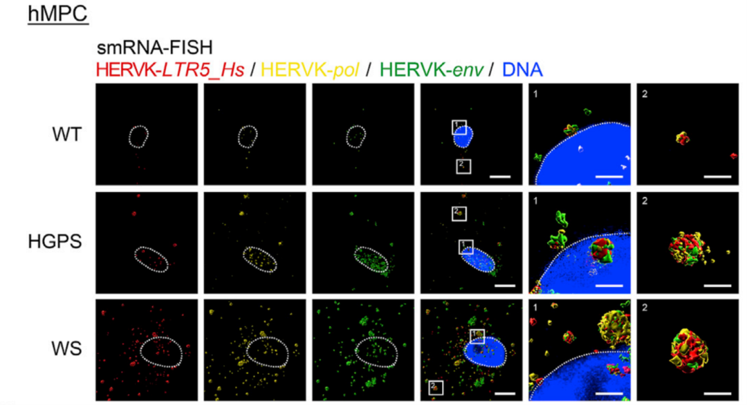 鲲羽生物助力2023年度国内十大科技新闻之我国科学家揭示衰老新机制-DNA FISH-RNA FISH-原位杂交-IVD-空间组-新一代病理 ...
