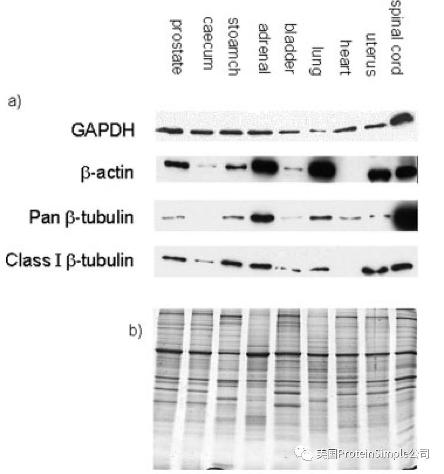 总蛋白作为Loading control是Western blot相对定量的必然趋势 - 普诺森生物科技（上海）有限公司ProteinSimple