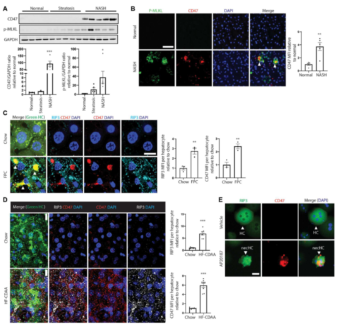 CD47：癌症之外也可治疗NASH - 脉脉