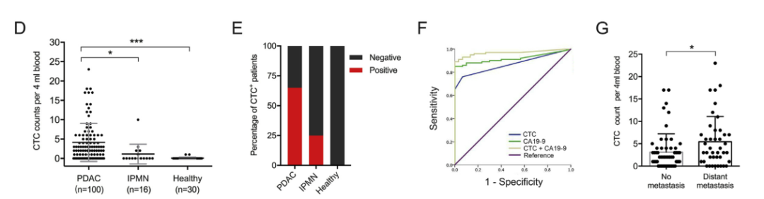 中华医学会肿瘤学分会胰腺癌早诊早治专家共识|CTC可作为胰腺癌早期诊断和鉴别诊断的标志物 - 企业动态 - 丁香通