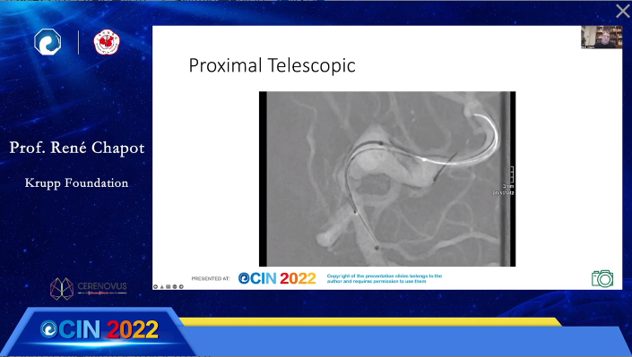 OCIN 2022 | 16日精彩回顾——五大论坛齐亮相 国际水准展神经介入新姿态 -- 严道医声网