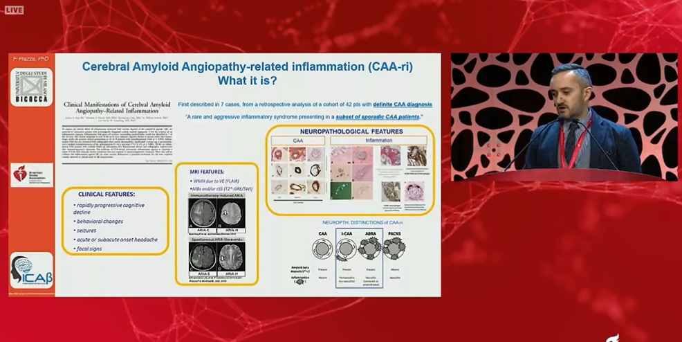 ISC2023 | 脑淀粉样血管病（cerebral amyloid angiopathy, CAA）专题 - 脑医汇 - 神外资讯 - 神介资讯