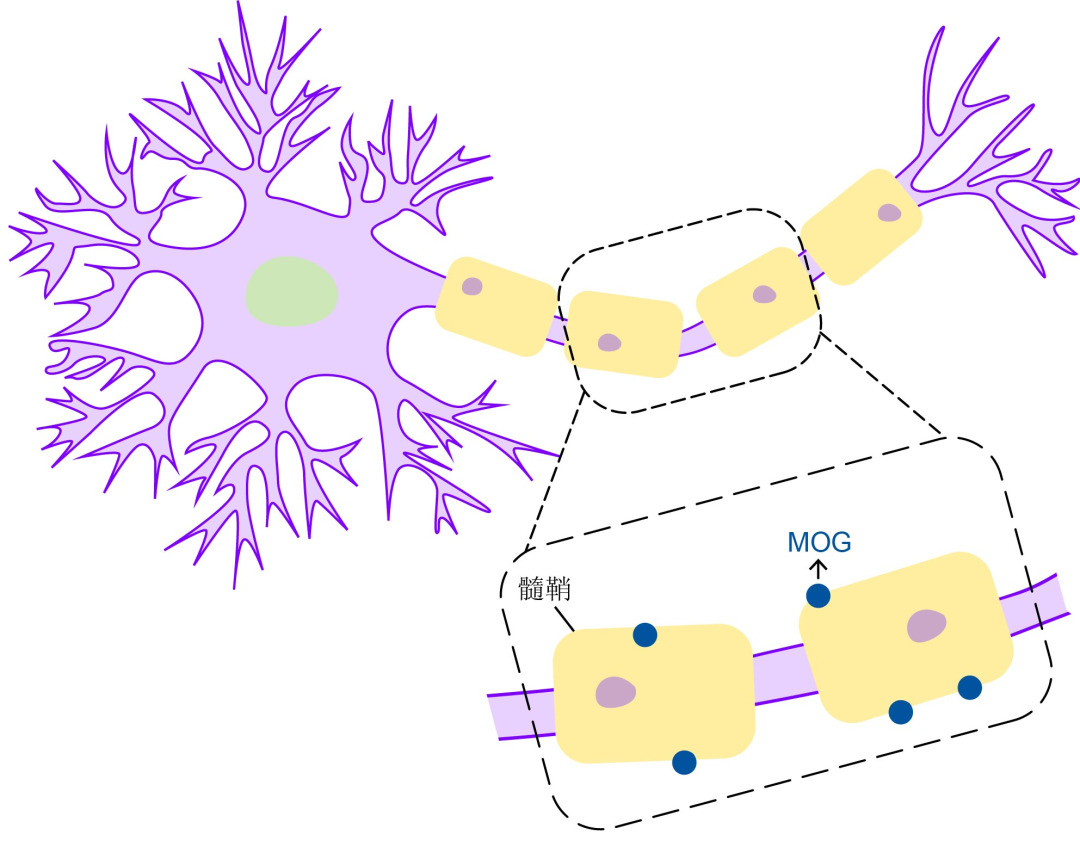 上海市儿童医院_带您了解儿童MOG相关性视神经炎