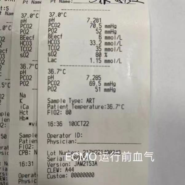 Crescent双腔·吾技无双 | 河南中医一附院开展院内首例双腔插管ECMO患者救治 -- 严道医声网