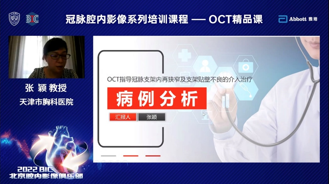 聚焦光学相干断层成像技术（OCT）- 北京腔内影像俱乐部（BIC）系列精品课程开讲啦！ -- 严道医声网