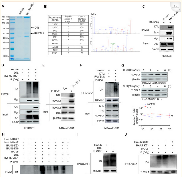 科学网—Cell Death Dis｜RUVBL1泛素化促进NHEJ通路转录调控并增强乳腺癌的放射抗性 - 杨鸽的博文