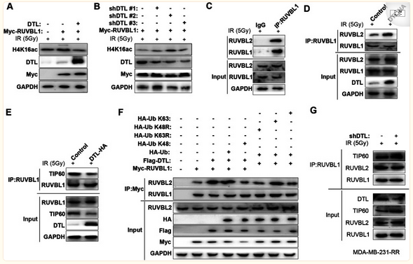 科学网—Cell Death Dis｜RUVBL1泛素化促进NHEJ通路转录调控并增强乳腺癌的放射抗性 - 杨鸽的博文