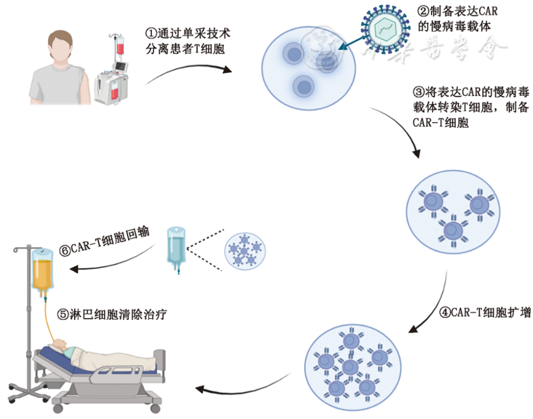 CAR-T 细胞疗法：技术演进、多领域应用（血液肿瘤 / 实体瘤 / 自身免疫病）及未来展望