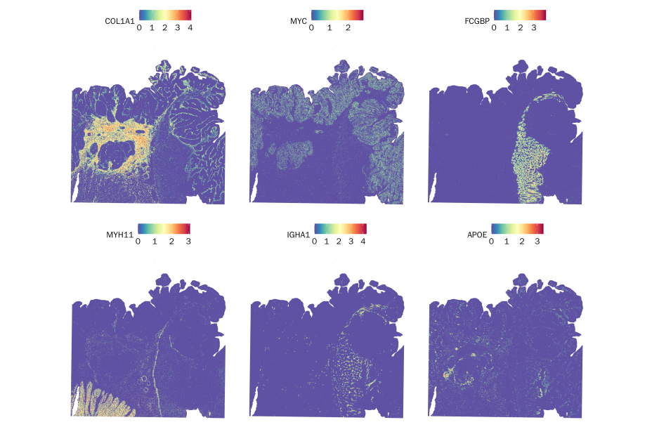 10x Visium HD新品数据开箱实测！-欧易生物