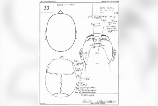洛杉矶华男弑母杀弟案宣判，陪审团裁定两项重罪成立