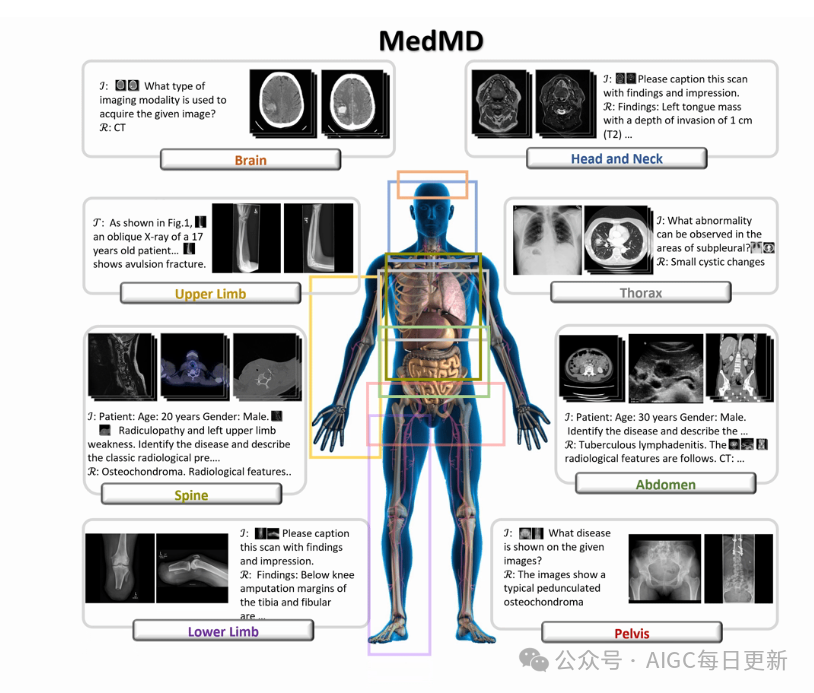 AIGC每周精选-医学影像大模型