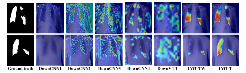 LViT: 语言与视觉Transformer在医学图像分割中的应用| 文献速递-深度学习结合医疗影像疾病诊断与病灶分割 - 影像组学科研世界 ...