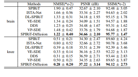 SPIRiT-Diffusion：基于自一致性驱动的加速MRI扩散模型|文献速递-基于深度学习的病灶分割与数据超分辨率 - 影像组学科研世界 ...