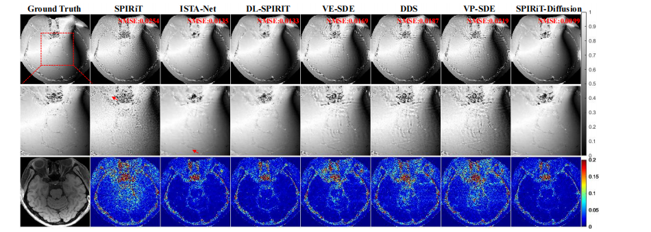 SPIRiT-Diffusion：基于自一致性驱动的加速MRI扩散模型|文献速递-基于深度学习的病灶分割与数据超分辨率 - 影像组学科研世界 ...