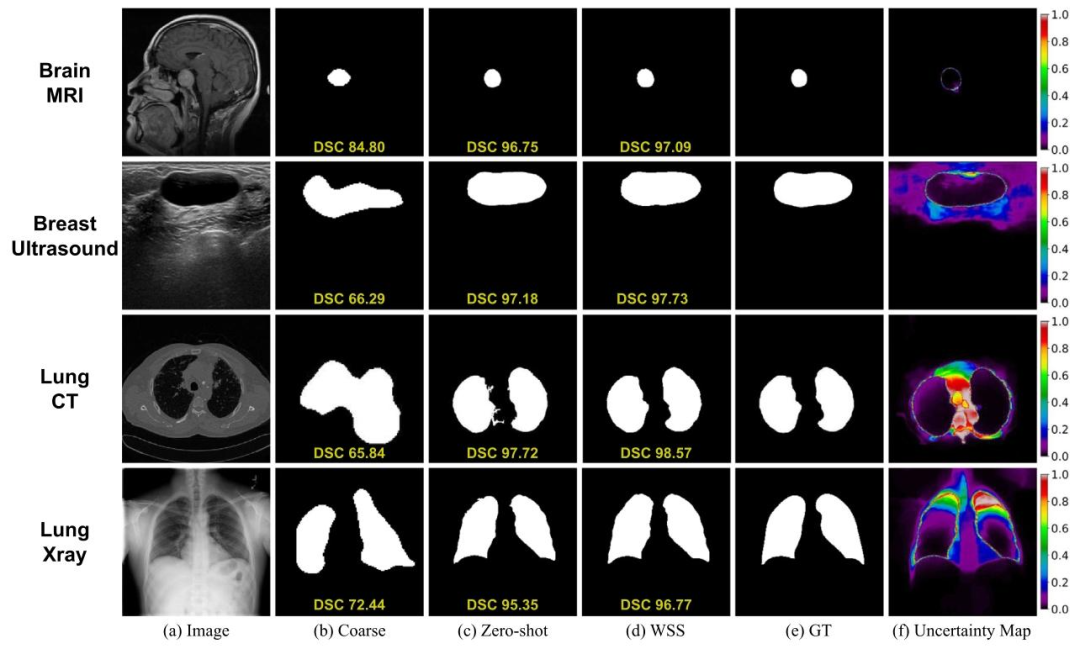 MedCLIP-SAMv2：迈向通用文本驱动的医学图像分割|文献速递-深度学习人工智能医疗图像 - 影像组学科研世界 | 国内第一个影像组学论坛